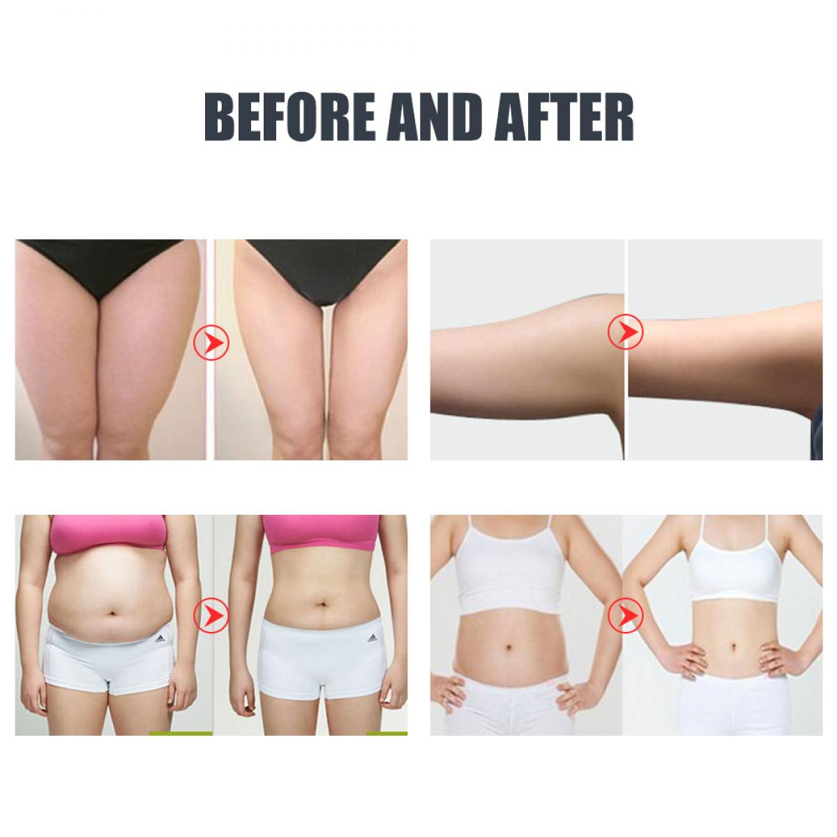 FREYARA Mini 40K Ultrasonic Cavitation Body Fat Burning Sculpting ...